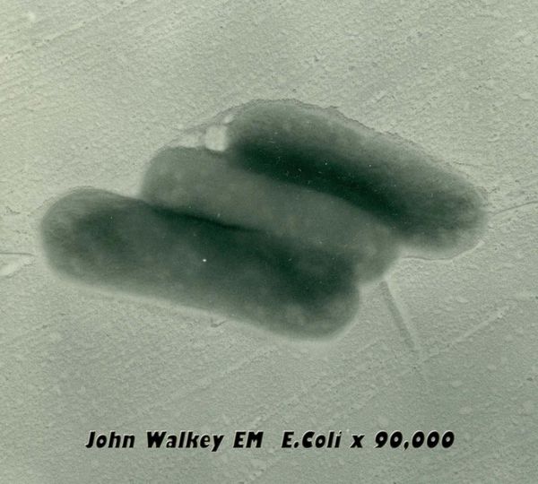 E Coli – John Walkey